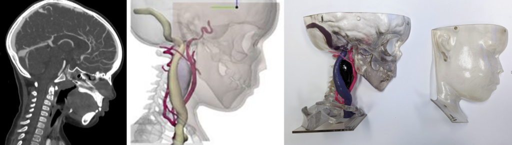 Anatomical Model Development & Fabrication Services For Medical Device ...